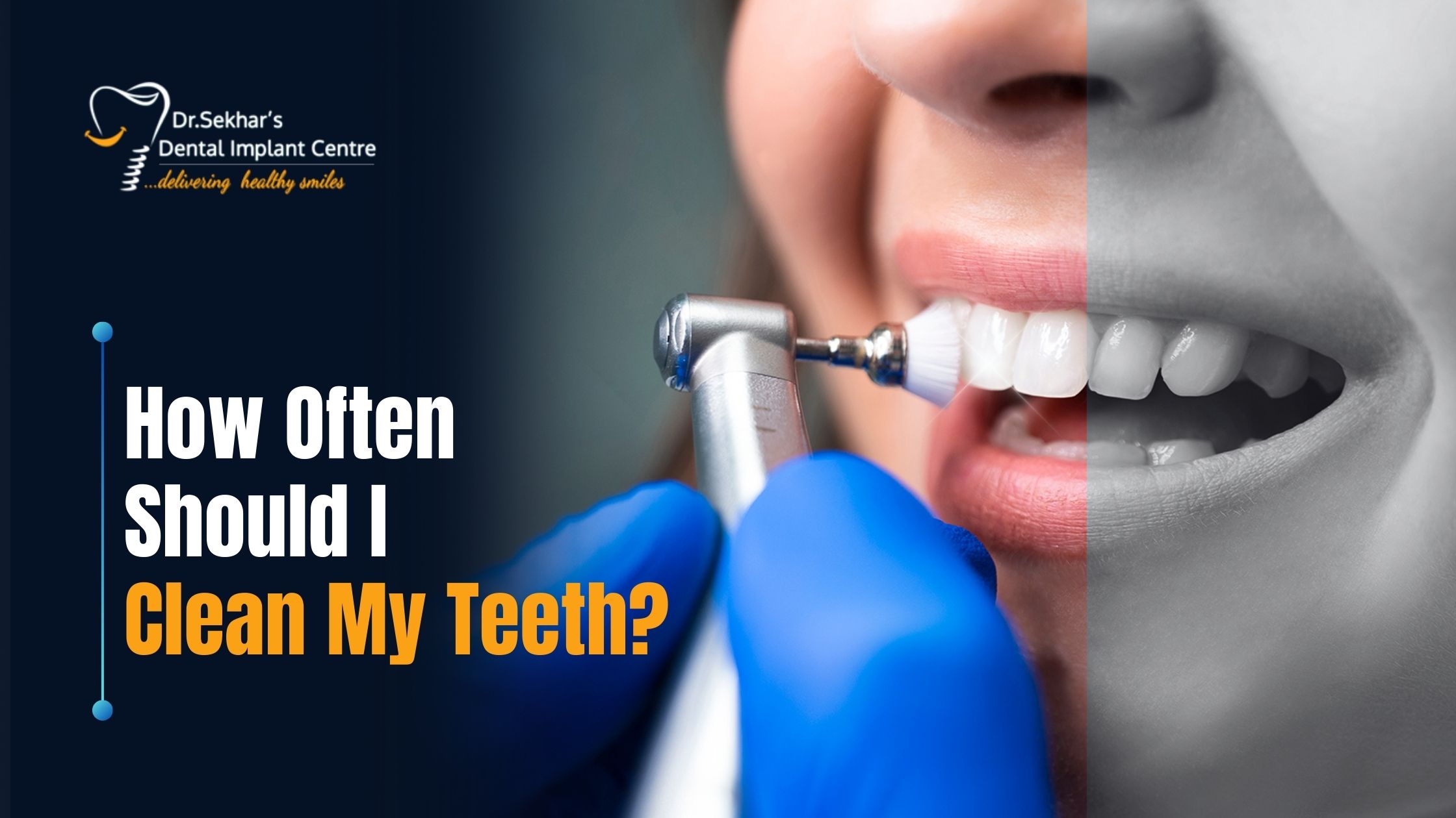 How Often Should You Clean Your Teeth?