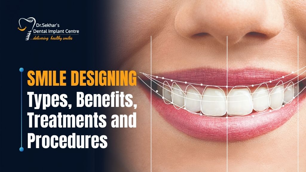 Smile Designing – Types, Benefits, Treatments and Procedures